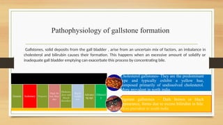Gallstones in Focus | PPTX