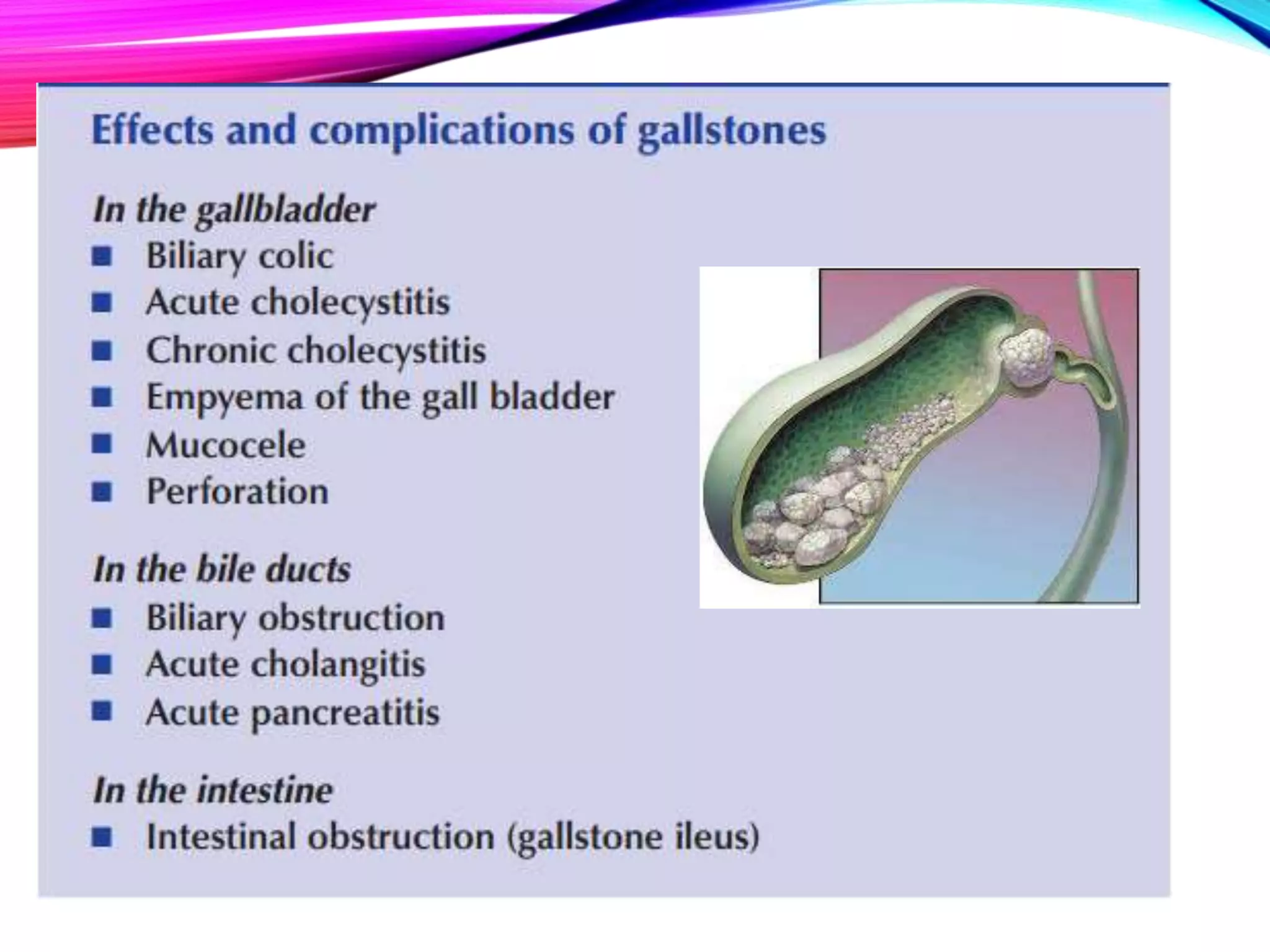Gallstones and it's Complications | PPTX