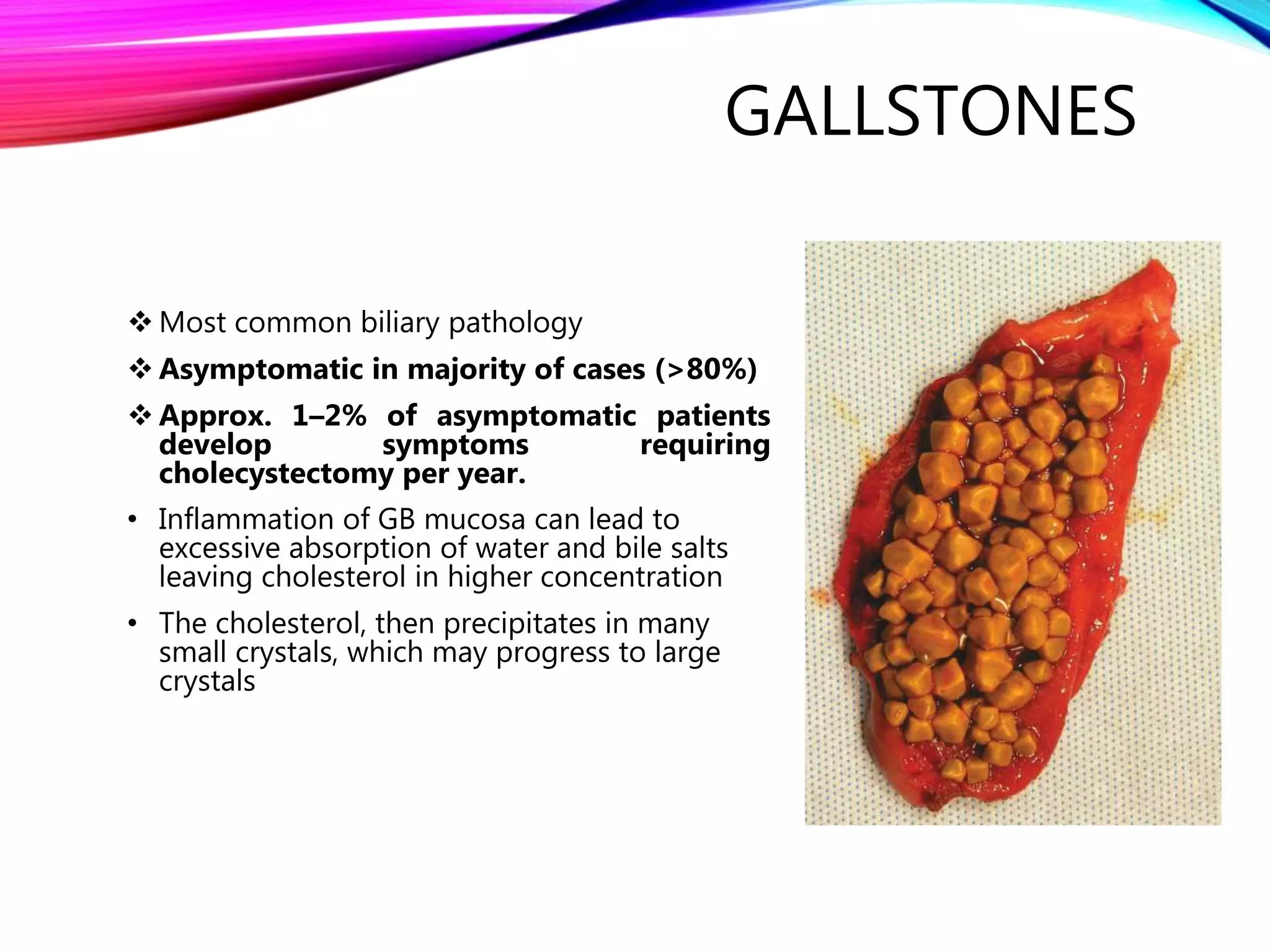 Gallstones and it's Complications | PPTX