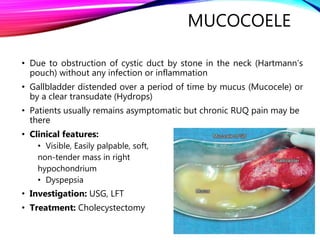 Gallstones and it's Complications | PPT
