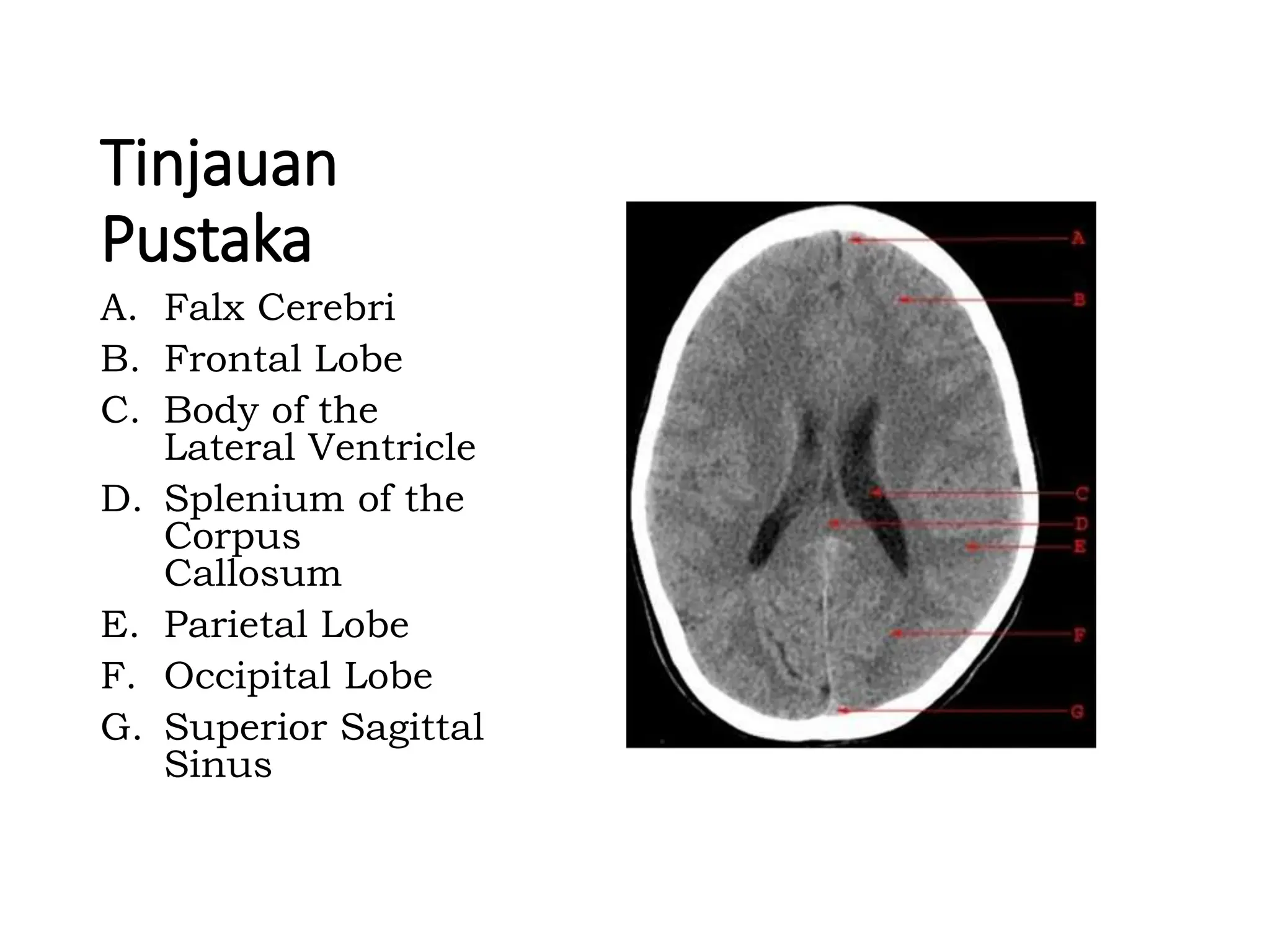 Gambaran CT Scan Radiologi CT Scan Radio | PPTX