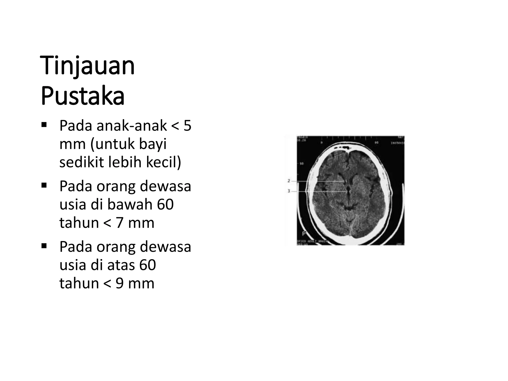 Gambaran CT Scan Radiologi CT Scan Radio | PPTX