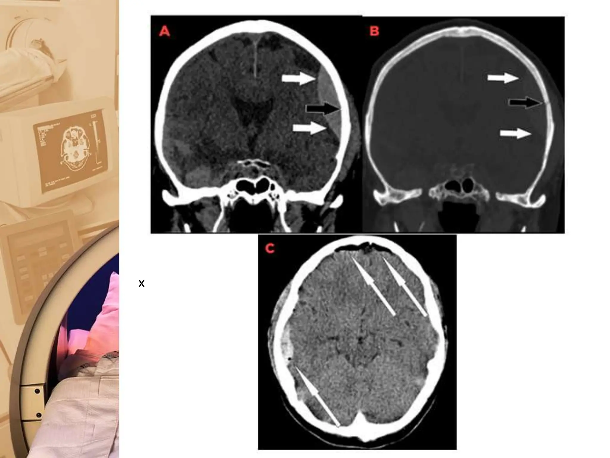 Gambaran CT Scan Radiologi CT Scan Radio | PPTX