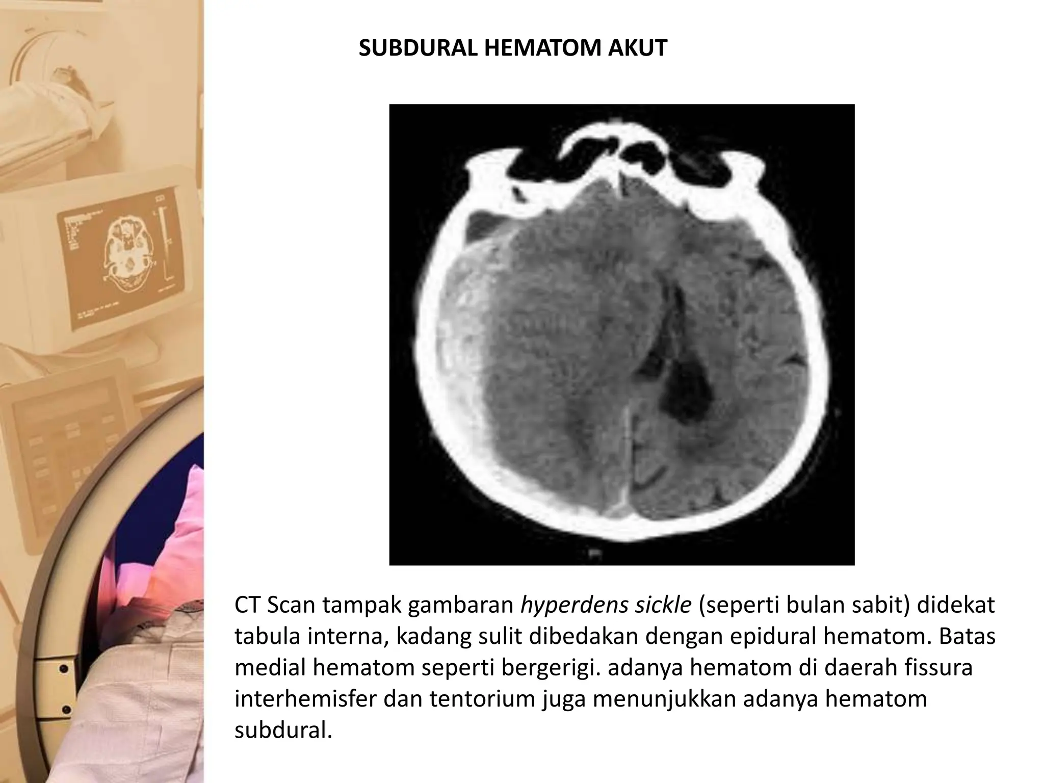 Gambaran CT Scan Radiologi CT Scan Radio | PPTX