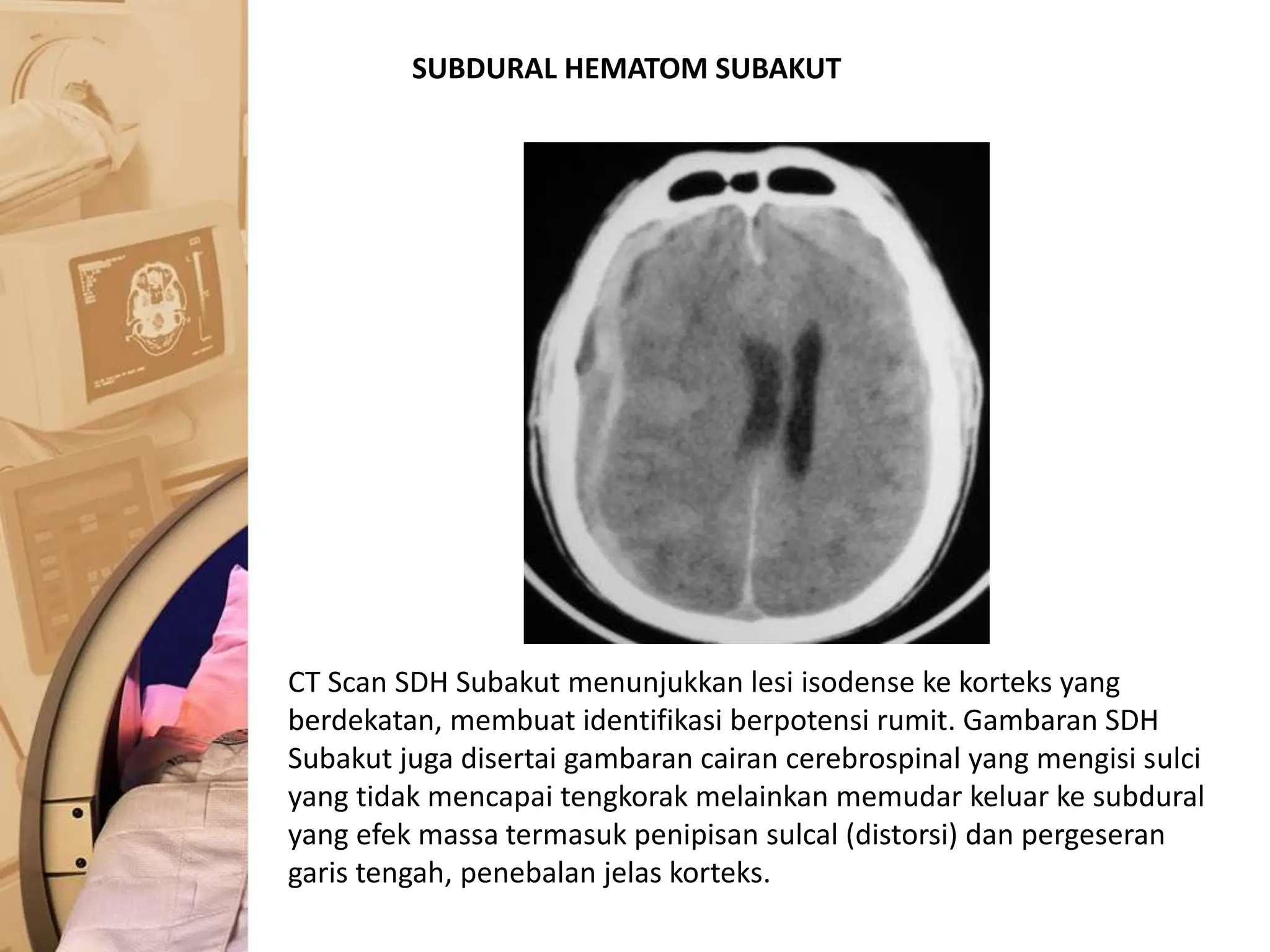Gambaran CT Scan Radiologi CT Scan Radio | PPTX