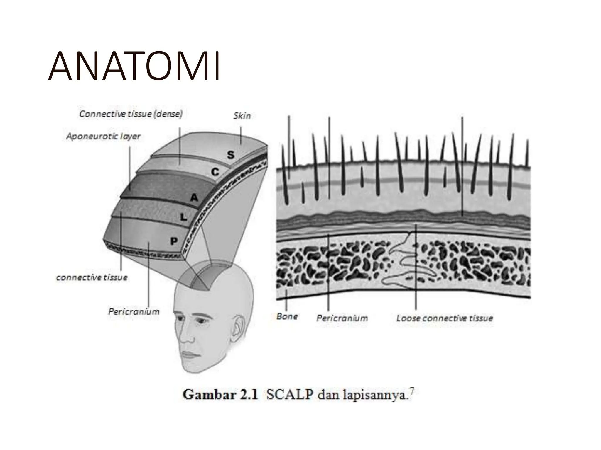 Gambaran CT Scan Radiologi CT Scan Radio | PPTX