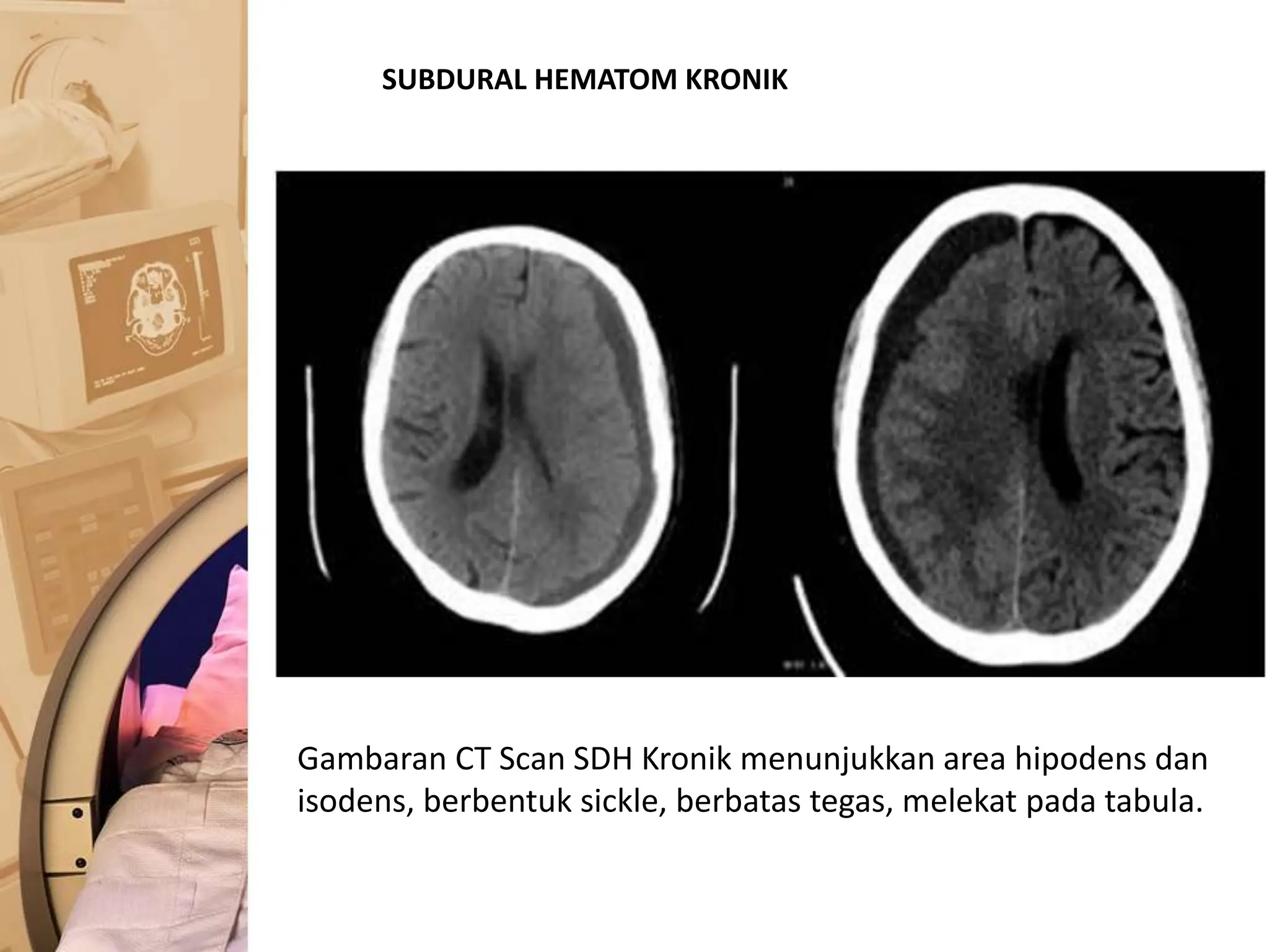 Gambaran CT Scan Radiologi CT Scan Radio | PPTX