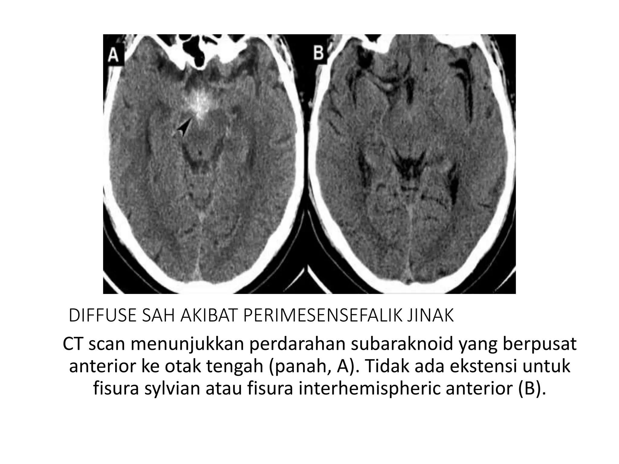 Gambaran CT Scan Radiologi CT Scan Radio | PPTX