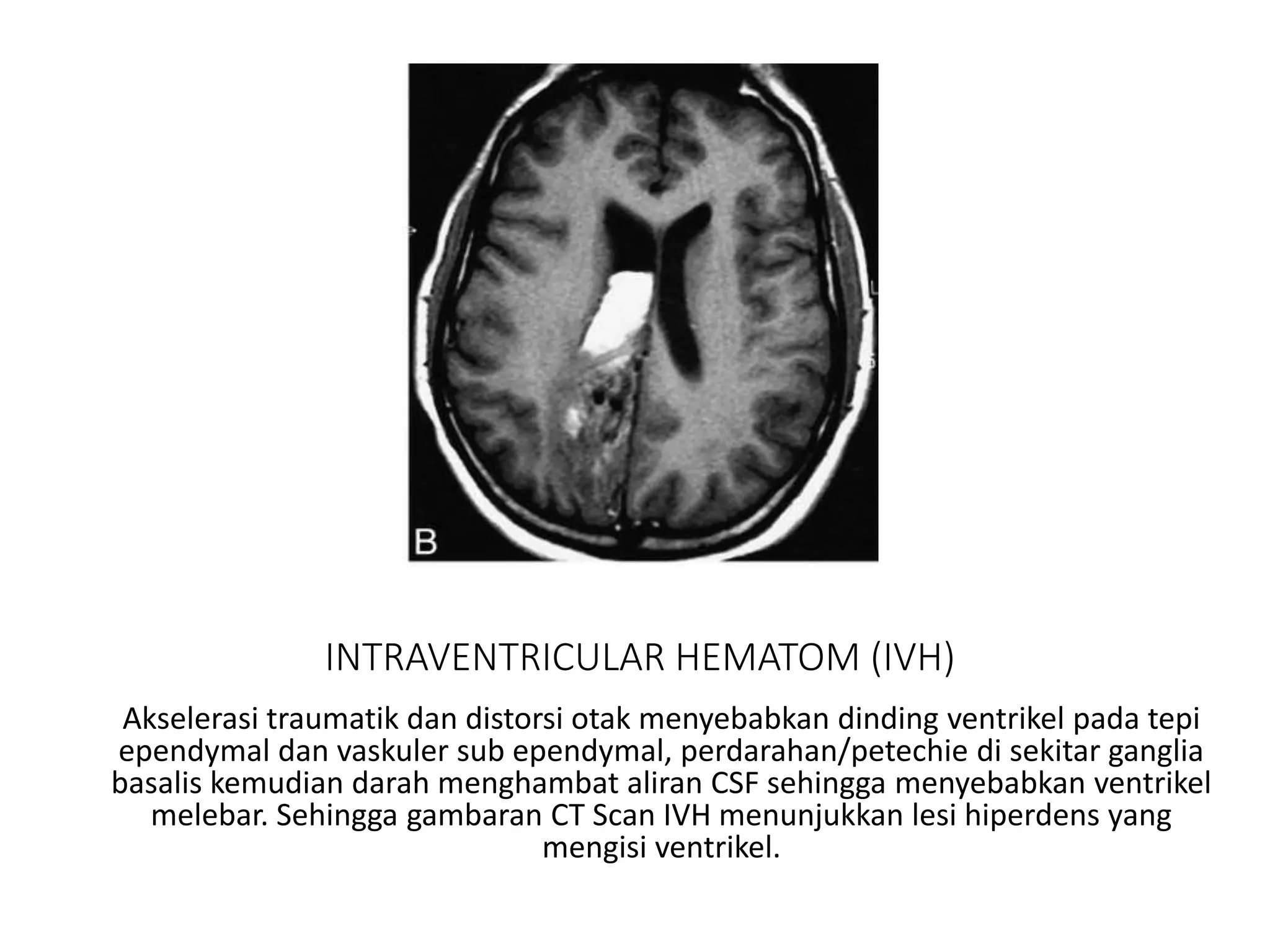Gambaran CT Scan Radiologi CT Scan Radio | PPTX