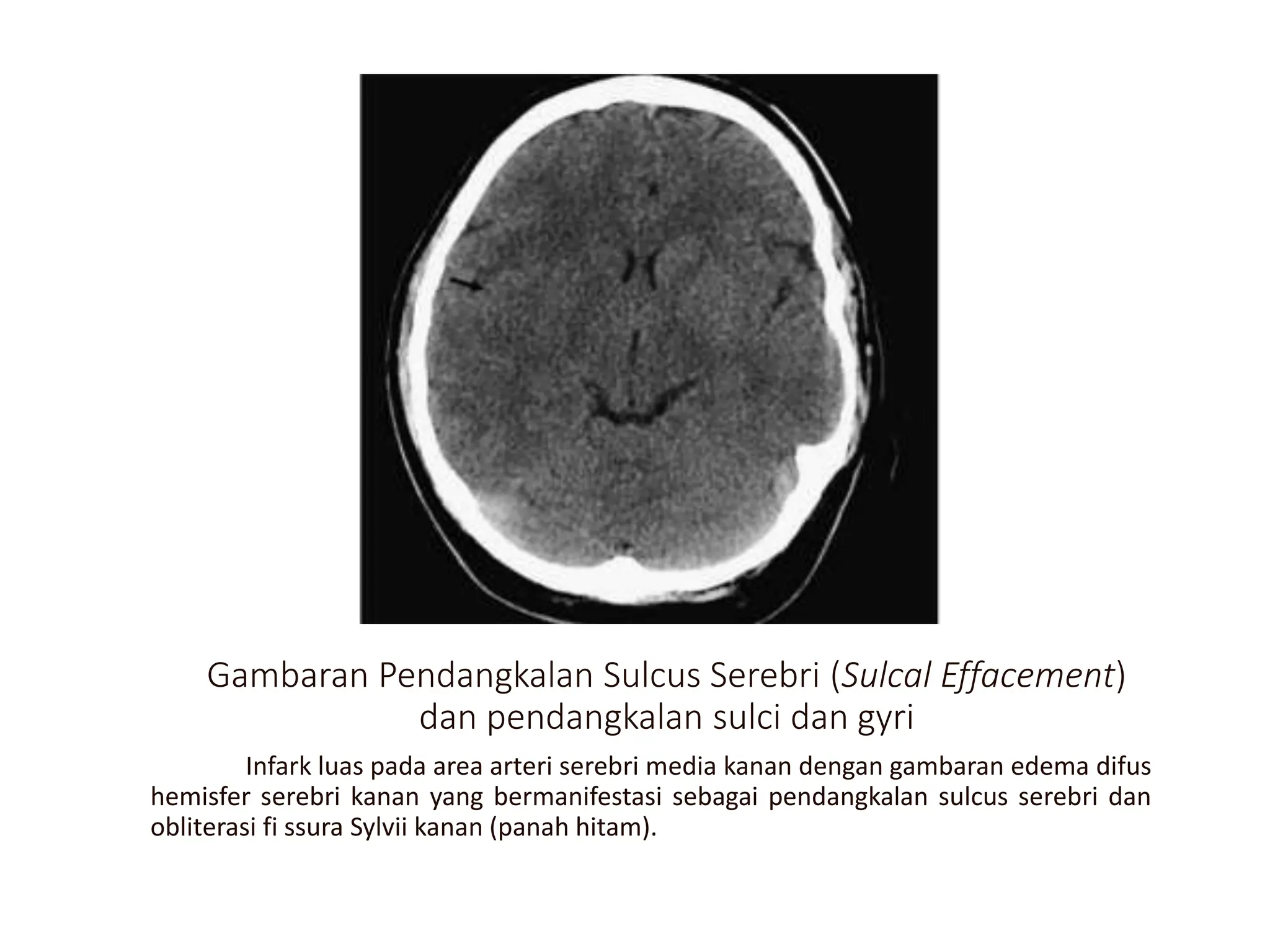 Gambaran CT Scan Radiologi CT Scan Radio | PPTX