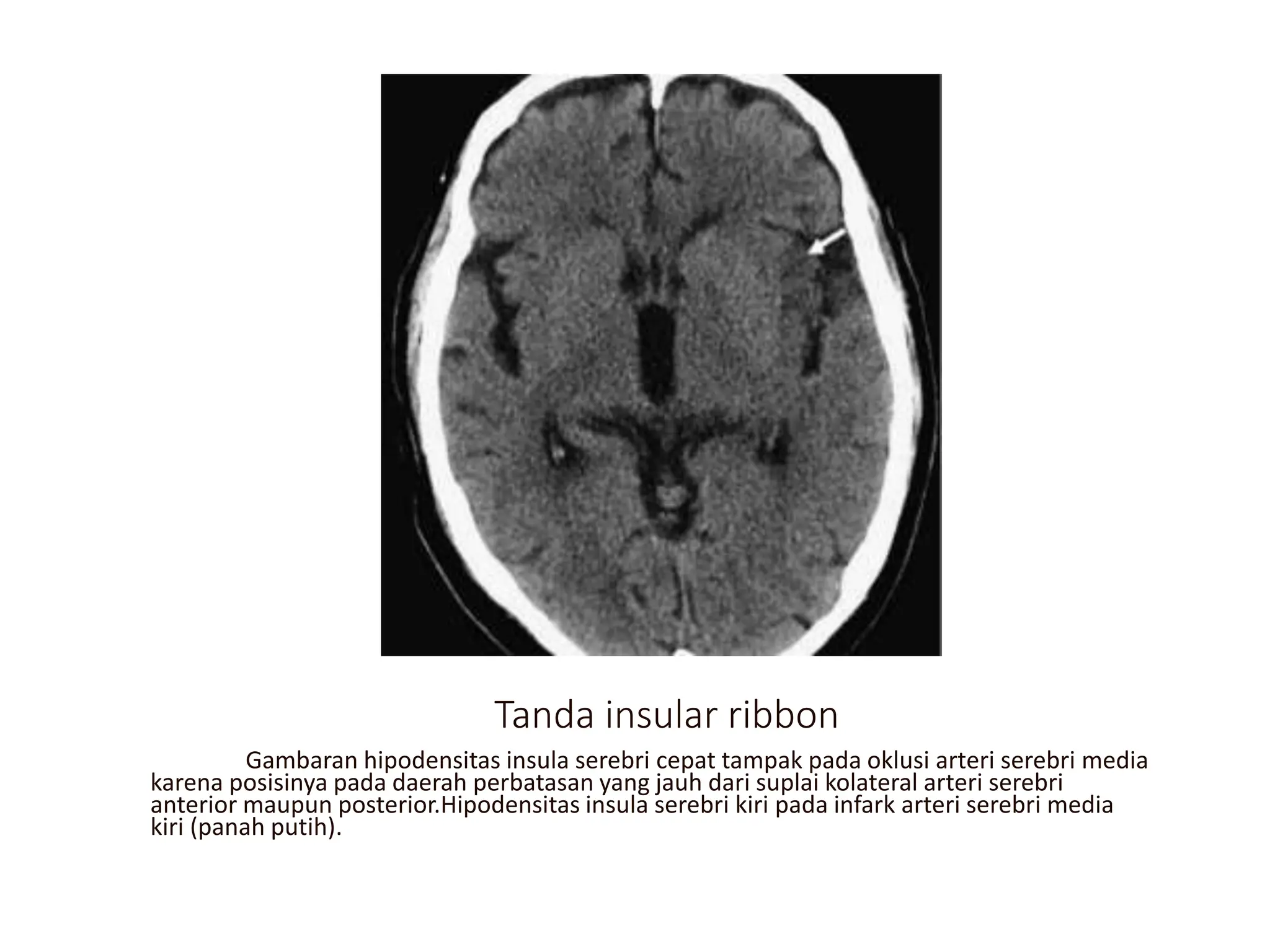 Gambaran CT Scan Radiologi CT Scan Radio | PPTX