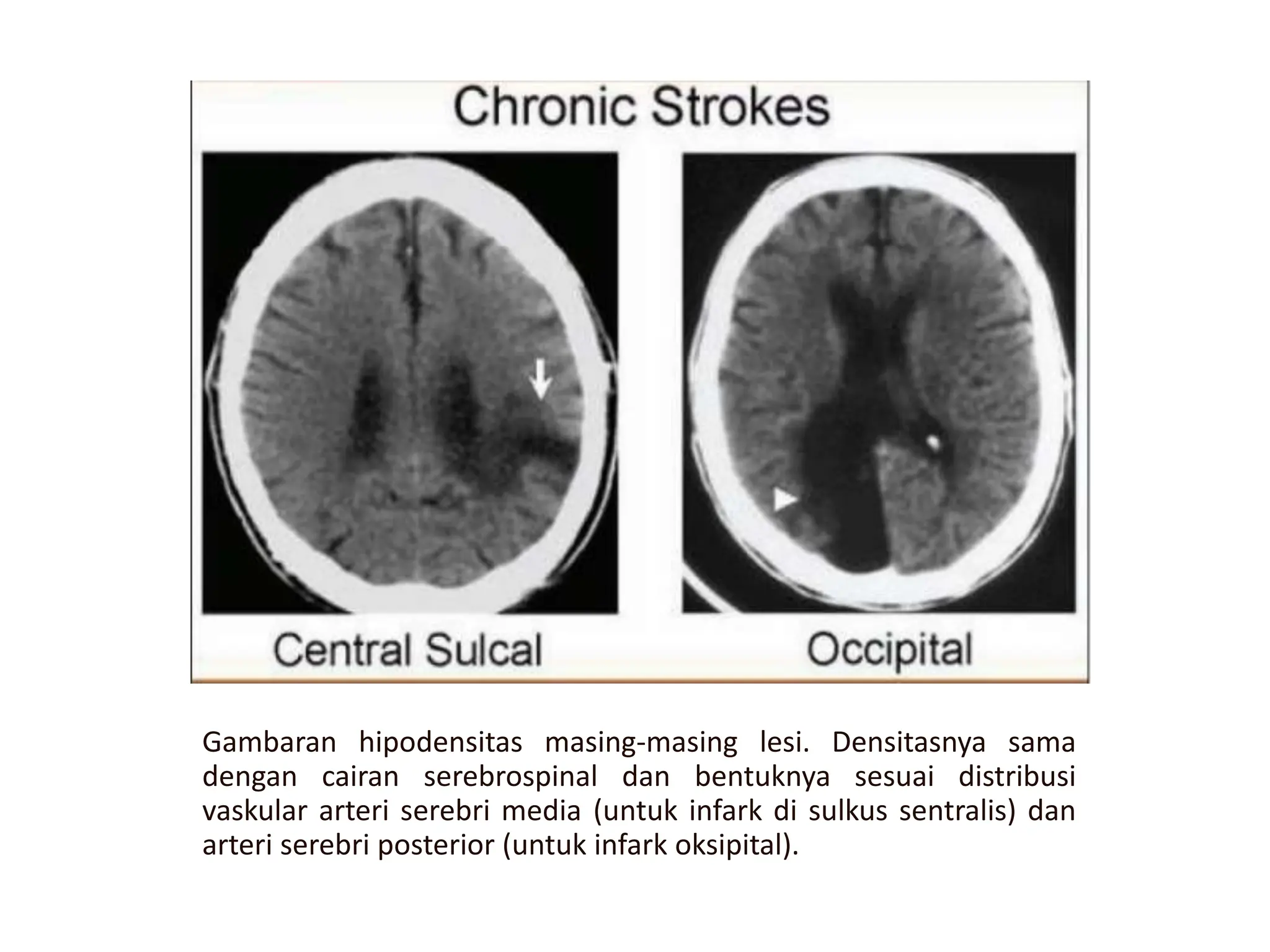 Gambaran CT Scan Radiologi CT Scan Radio | PPTX