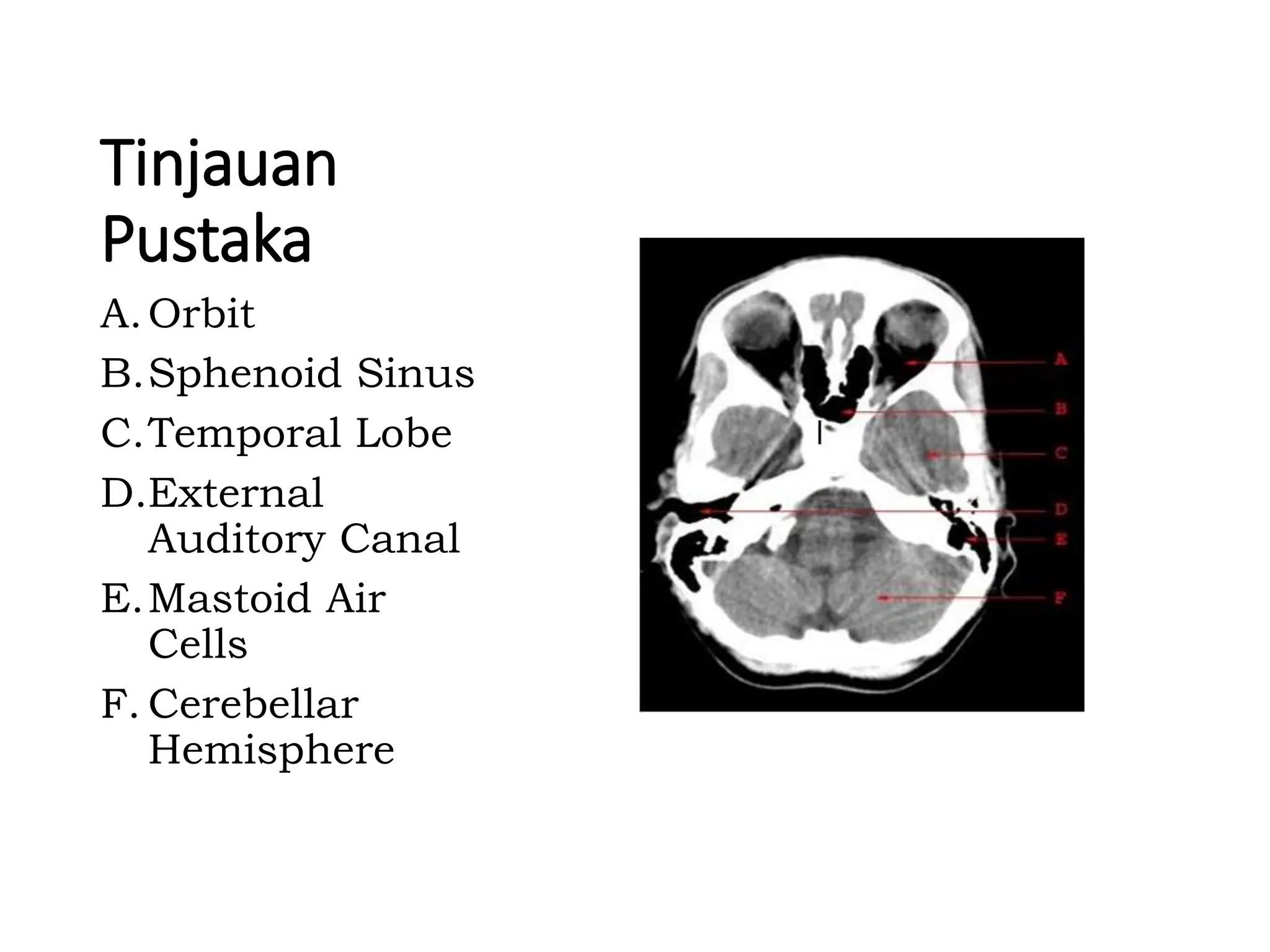 Gambaran CT Scan Radiologi CT Scan Radio | PPTX