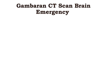 Gambaran CT Scan Radiologi CT Scan Radio | PPTX