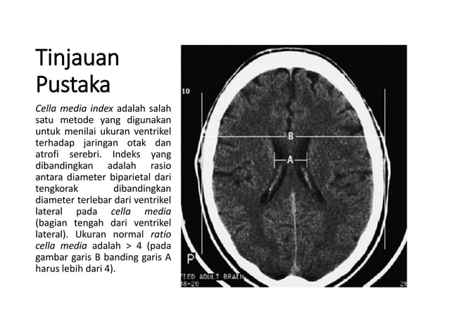 Gambaran CT Scan Radiologi CT Scan Radio | PPTX
