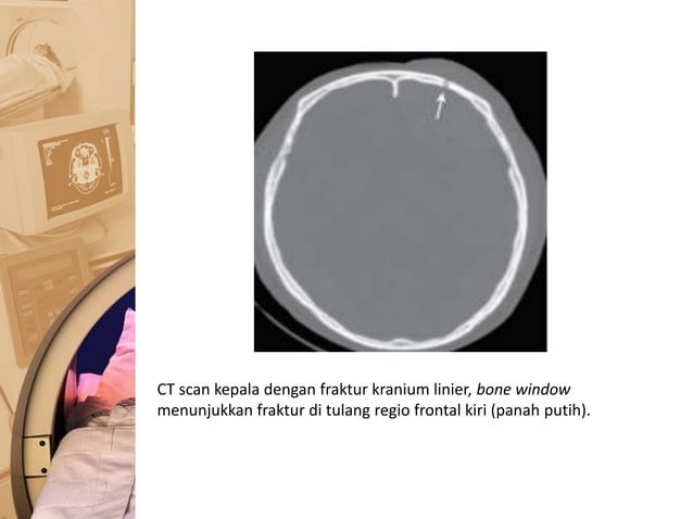 Gambaran CT Scan Radiologi CT Scan Radio | PPTX