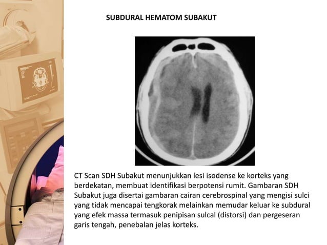 Gambaran CT Scan Radiologi CT Scan Radio | PPTX