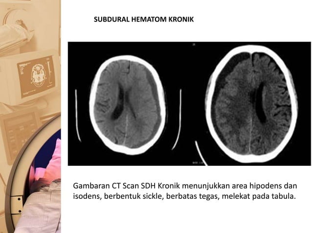 Gambaran CT Scan Radiologi CT Scan Radio | PPTX