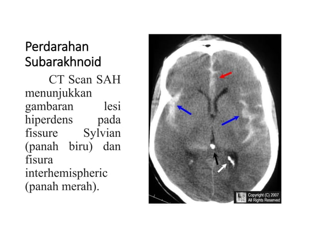 Gambaran CT Scan Radiologi CT Scan Radio | PPTX