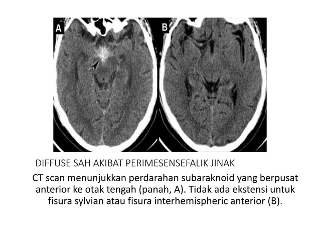 Gambaran CT Scan Radiologi CT Scan Radio | PPTX