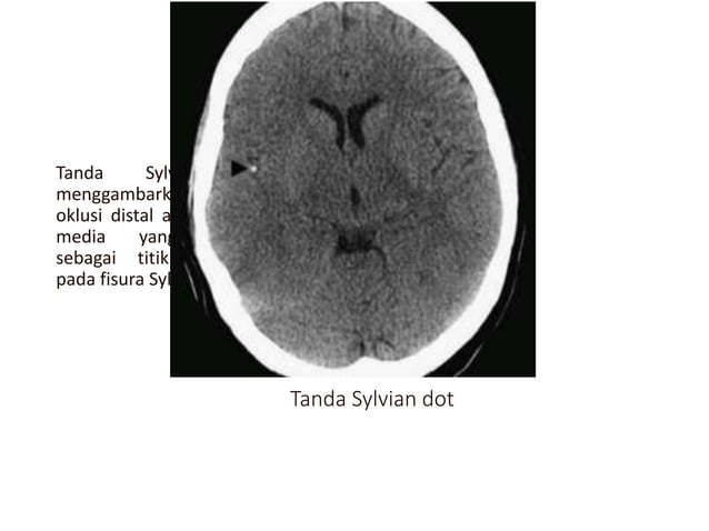 Gambaran CT Scan Radiologi CT Scan Radio | PPTX