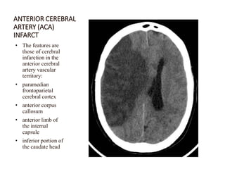 Gambaran CT Scan Radiologi CT Scan Radio | PPTX