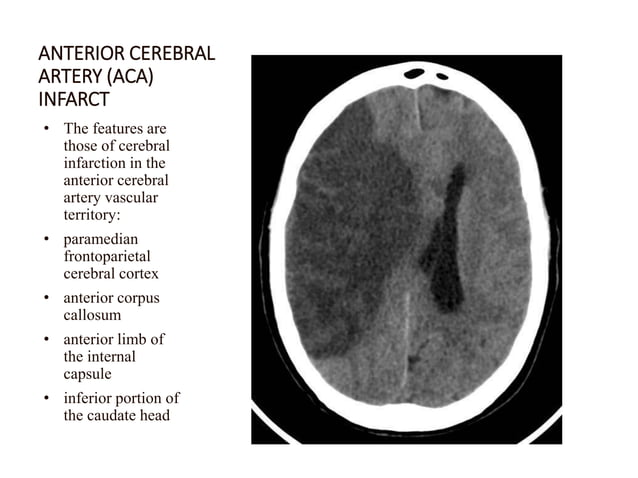 Gambaran CT Scan Radiologi CT Scan Radio | PPTX