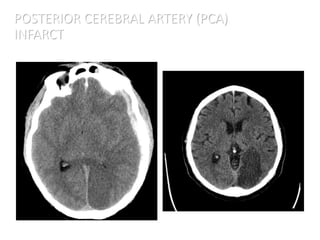 Gambaran CT Scan Radiologi CT Scan Radio | PPTX