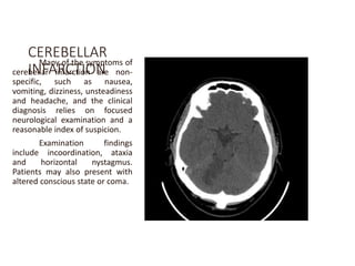 Gambaran CT Scan Radiologi CT Scan Radio | PPTX