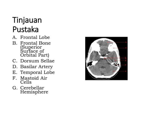 Gambaran CT Scan Radiologi CT Scan Radio | PPTX