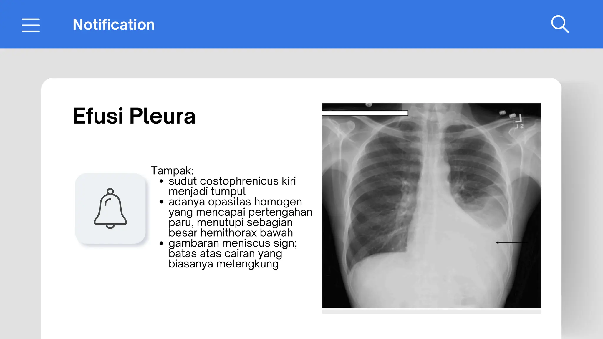 Gambaran Foto Thoraks patologis untuk penunjang diagnosa.pdf