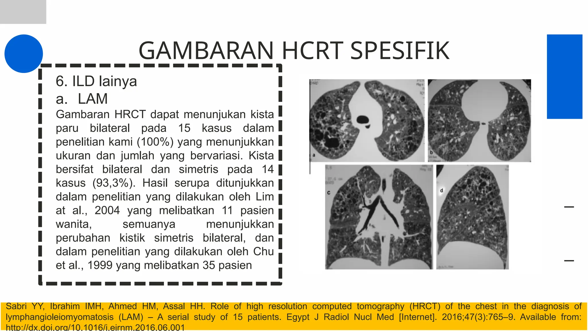 GAMBARAN HCRT PADA ILD interistial lung dissease | PPTX