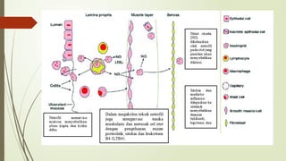 Gambaran Radiologi Megakolon Toksik.pptx
