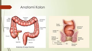 Gambaran Radiologi Megakolon Toksik.pptx