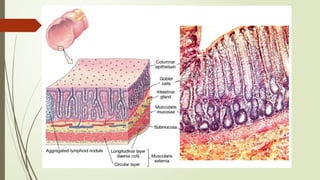 Gambaran Radiologi Megakolon Toksik.pptx