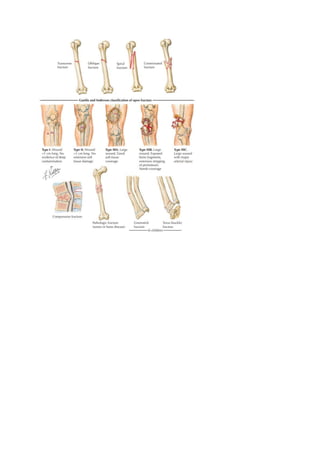 Beberapa Gambar Netter Anatomy Orthopedi | DOCX