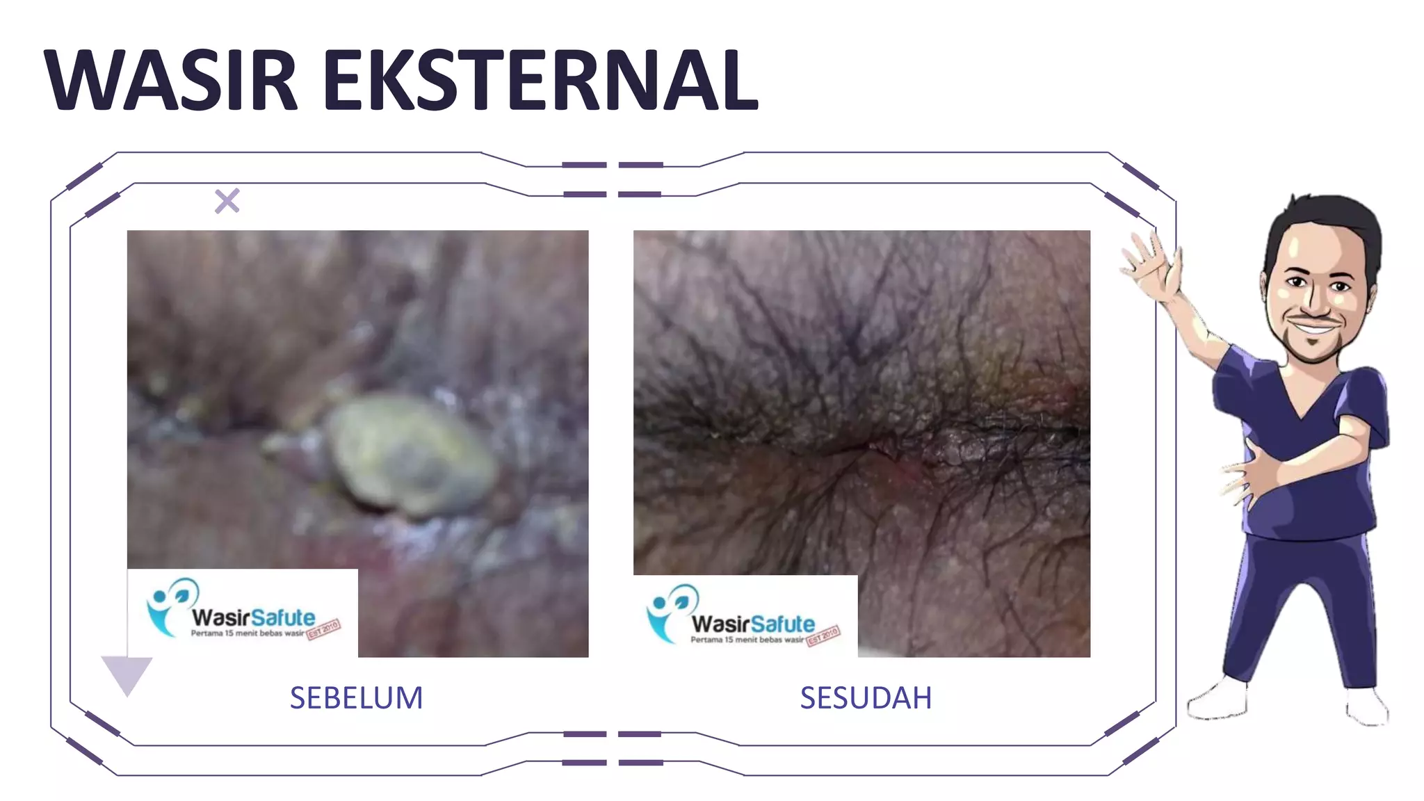 Gambar sebelum sesudah | PPTX