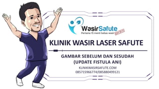 Gambar sebelum sesudah | PPT