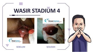 Gambar sebelum sesudah | PPTX