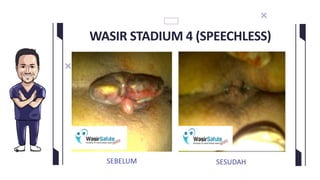 Gambar sebelum sesudah | PPTX