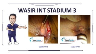 Gambar sebelum sesudah | PPTX