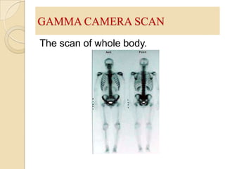 Gamma Camera | PPTX