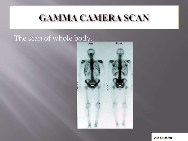 Gamma Camera | PPTX