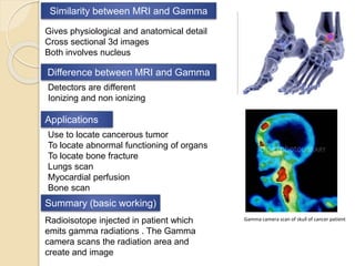 Gamma camera | PPTX