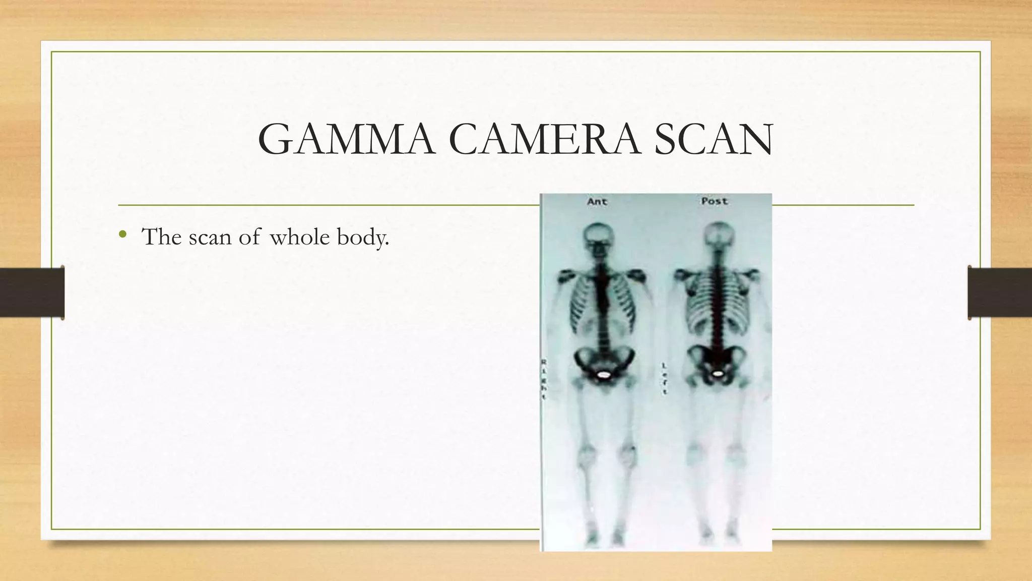 Gamma Camera.pptx