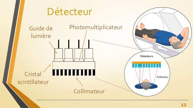 Gamma camera scintigraphie