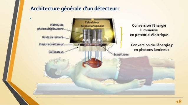 Gamma camera scintigraphie