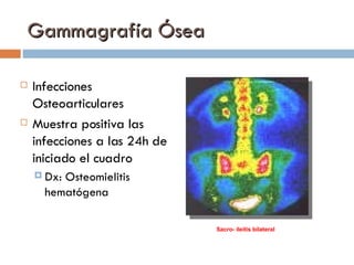 Gammagrafia Ósea | PPT