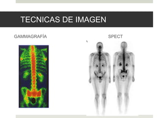 Gammagrafia osea | PPTX