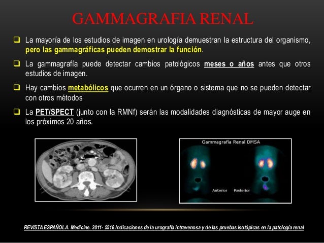 ESTUDIOS COMPLEMENTARIOS: Gammagrafia Renal